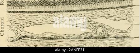 Cyclopia human Stock Photo - Alamy