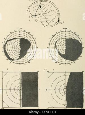 AMAarchives of neurology & psychiatry . Fig. 8 (Charts 8, F. D.).—Right ...