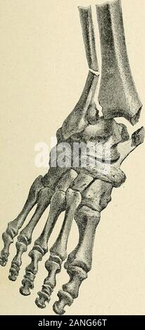 First aid treatment of lower leg injury, helping casualty to lie down ...