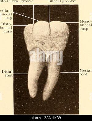 Principles and practice of operative dentistry . Mesio-lingual cuspFig ...