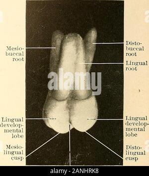 Principles and practice of operative dentistry . Buccal grooveFig. 63 ...