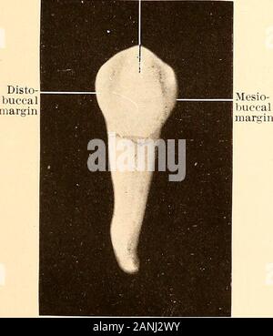 Principles and practice of operative dentistry . Buccal grooveFig. 63 ...