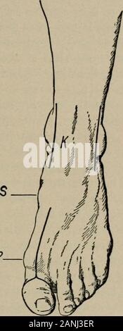 Operative surgery, for students and practitioners . ,etc., below this ...