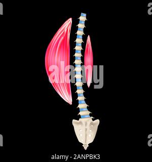 Left-sided scoliosis. Levoscoliosis. Muscles and spine. Spinal ...