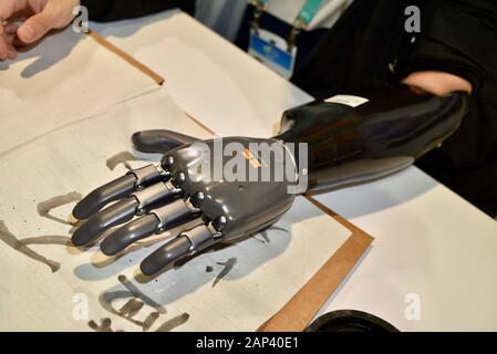 BrainCo prosthetic arm and hand using artificial intelligence and ...