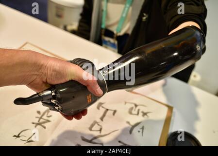 BrainCo prosthetic arm and hand using artificial intelligence and ...