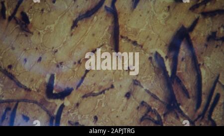 metallurgical micrograph of flake grey iron from a vice casting Stock ...