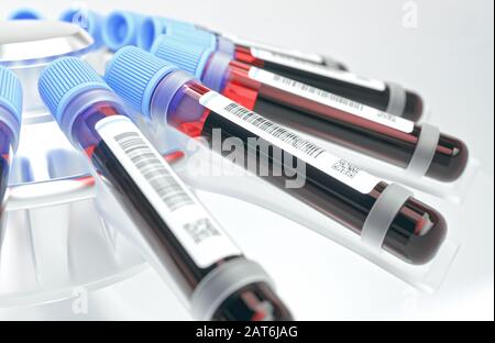 Blood test tubes in centrifuge. Plasma preparation in medical ...