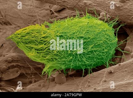 Ciliate protozoa. Coloured scanning electron micrograph (SEM) of ...