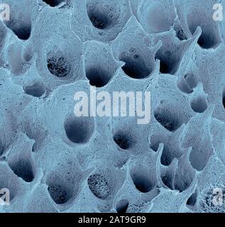 Tooth tissue. Coloured scanning electron micrograph (SEM) of tooth ...