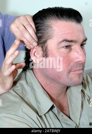 TV chef Ross Burden undergoing an acupuncture procedure at the Hale ...