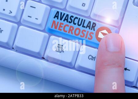 Writing note showing Avascular Necrosis. Business concept for death of ...