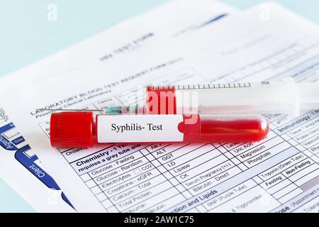 checklist, scientific experiment, blood test, checklists, scientific ...