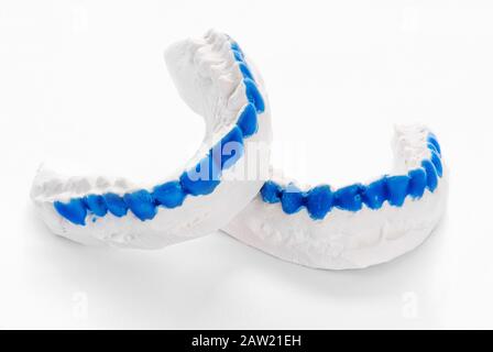 Model a set of teeth, upper and lower jaw Stock Photo - Alamy
