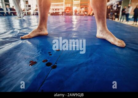Fighter mma with blood after sparring in battle. Concept boxer fight ...
