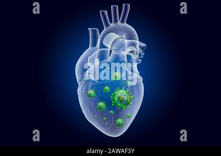 Virus Infection And Heart Attack as Myocarditis inflammation as an ...