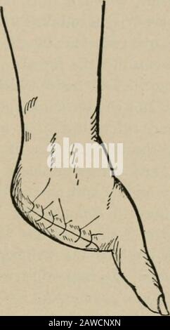 Operative surgery, for students and practitioners . ,etc., below this ...