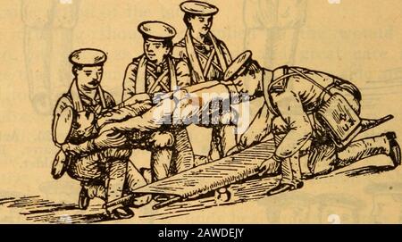 First Aid, Two Handed Seat - Vintage Cigarette Card Illustration Stock ...