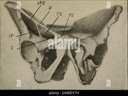 . Operative surgery, for students and practitioners . an portion of the ...