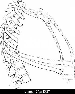 Costal Angle 90 Degrees