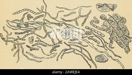 scalp under the microscope Stock Photo - Alamy