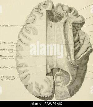 lateral commissure function