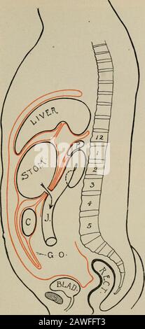 . Operative surgery, for students and practitioners . Lembert suturesof ...