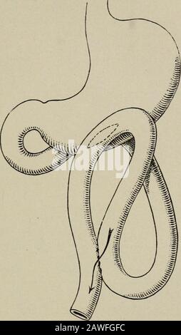 Operative surgery, for students and practitioners . ,etc., below this ...