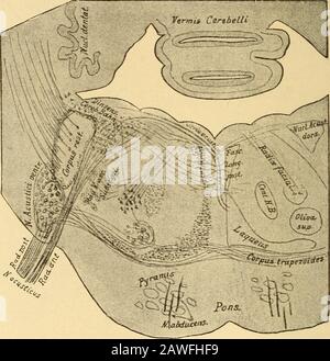 . Diseases of the nervous system . medialis - Nucleus olivaris inferior ...