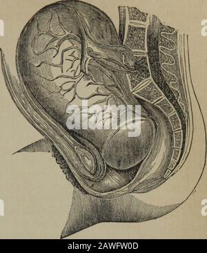 Foetus in amniotic sac Stock Photo - Alamy