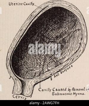 Ballottement Pregnancy