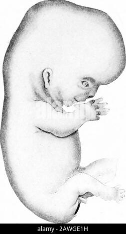 Human Embryo 7 mm. long, Showing the Umbilical Region Stock Photo - Alamy