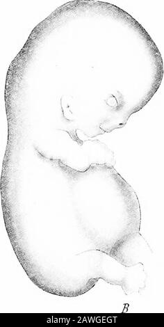 Human Embryo 7 mm. long, Showing the Umbilical Region Stock Photo - Alamy