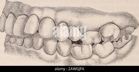 Row of molar teeth in lower jaw of a horse, Equus ferus caballus Stock ...