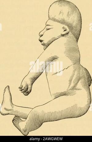 COLLEGE OF PHYSICIANS & MUTTER MUSEUM PHILADELPHIA PENNSYLVANIA Stock ...