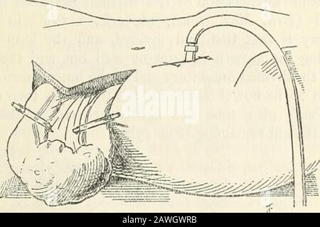 The Practitioner . Fi. 12. Entcrccioiiiy (just before and during the ...
