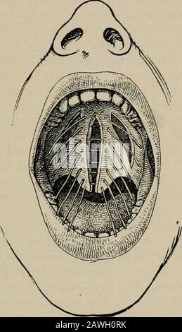 Operative surgery, for students and practitioners . or border of this ...