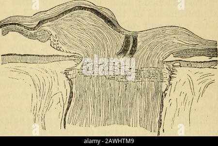 Retinal diseases blood test Stock Photo - Alamy
