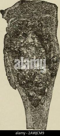 General surgery and pathology for dentists . Fig. 17.PAPILLOMA OF SKIN ...