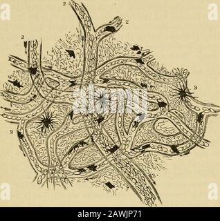 Red Blood Cells Enmeshed in Fibrinous Matrix Stock Photo - Alamy