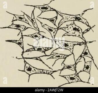 General surgery and pathology for dentists . Fig. 17.PAPILLOMA OF SKIN ...