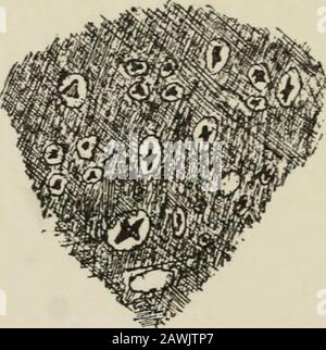 General surgery and pathology for dentists . Fig. 17.PAPILLOMA OF SKIN ...