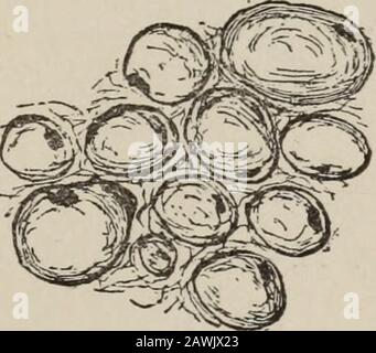 General surgery and pathology for dentists . Fig. 17.PAPILLOMA OF SKIN ...