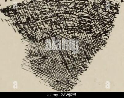 General surgery and pathology for dentists . Fig. 17.PAPILLOMA OF SKIN ...