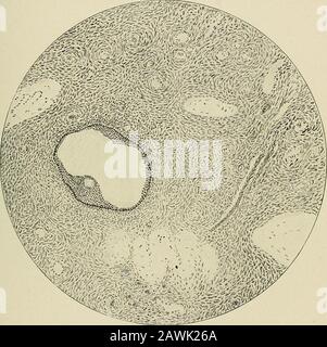 . Gynecology : . been somequestion as to the origin of the cells that ...