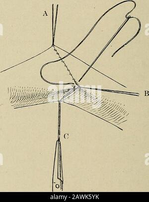 artery clamp straight Stock Photo - Alamy