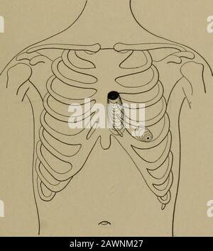 Physical diagnosis, including diseases of the thoracic and abdominal ...