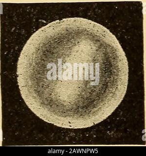 Skiascopy and its practical application to the study of refraction ...