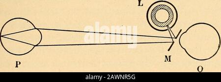 Skiascopy and its practical application to the study of refraction ...