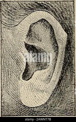 Nervous and mental diseases . Fig. 291.—stahl ear, No. 1. Fig. 292 ...